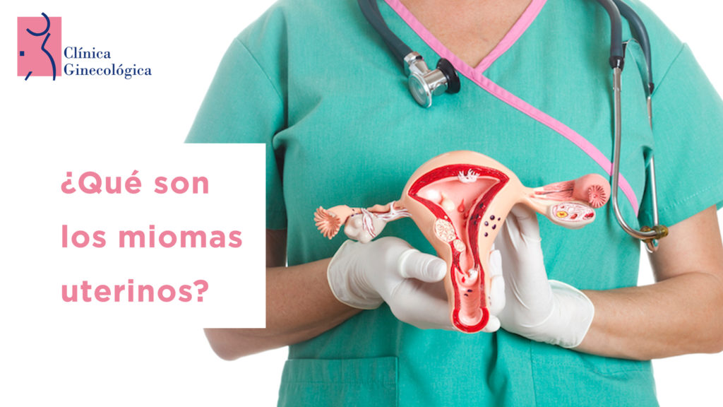 Miomas en el útero archivos - Clínica Ginecológica